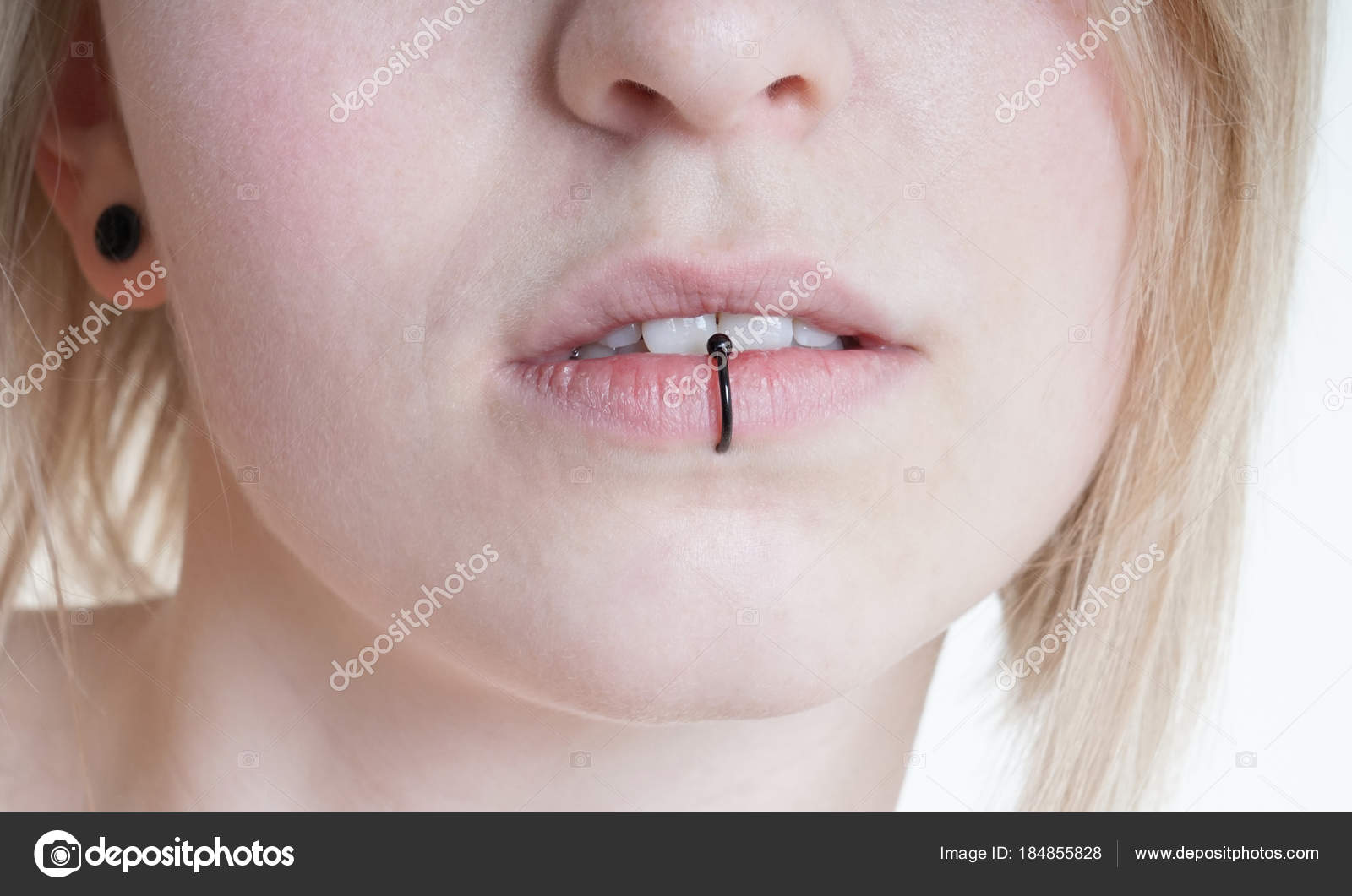 Leppe Piercing Infeksjon