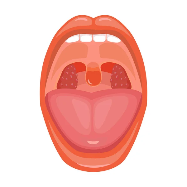 Pharyngitis Vector Images | Depositphotos