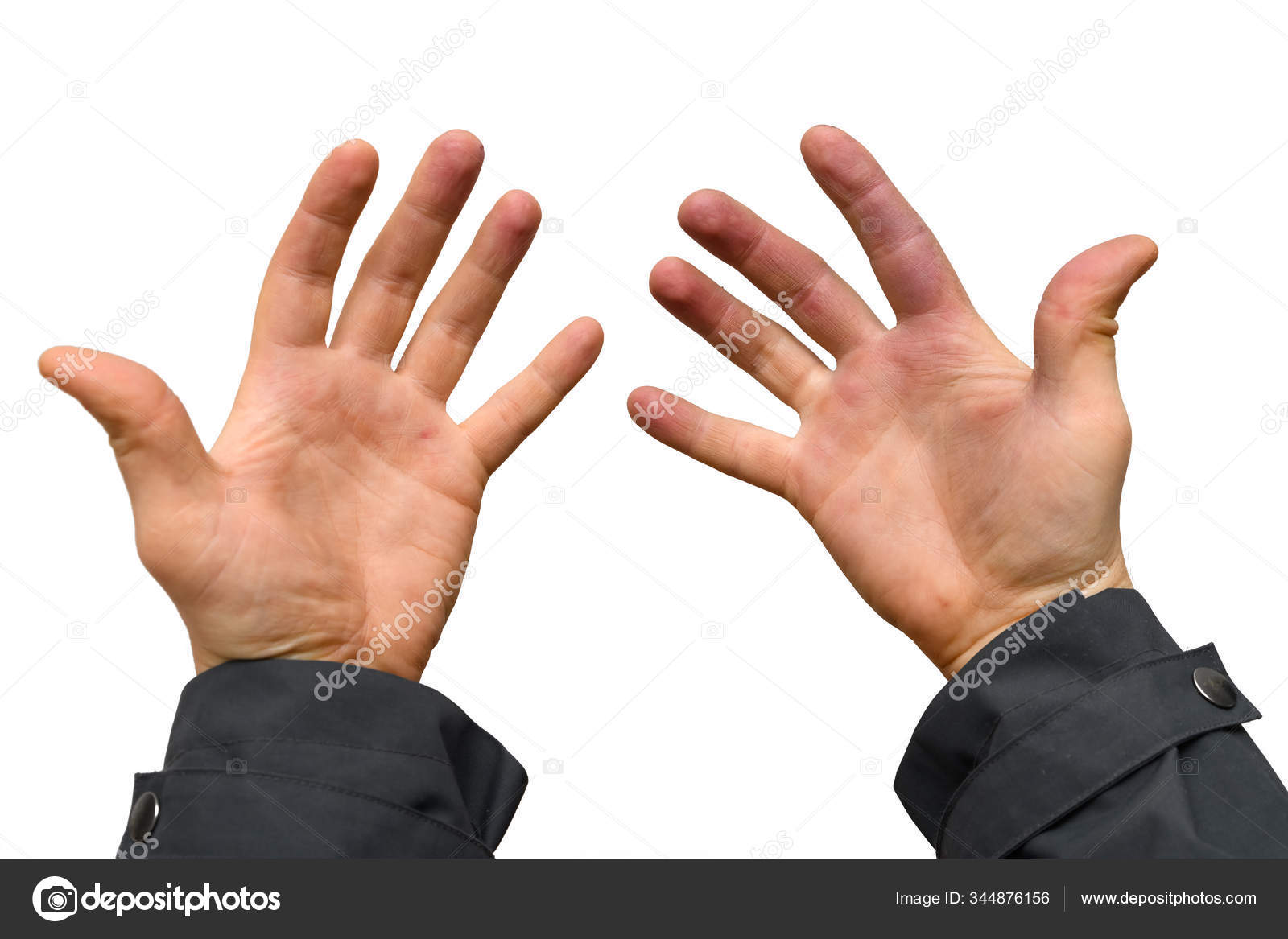 Frostbite marks on a man's hand on a white isolated background Stock ...