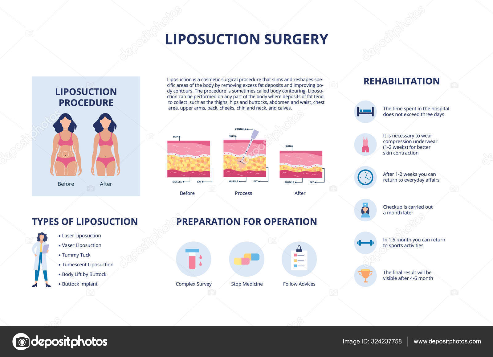 Liposuction body plastic surgery with characters and text, vector ...