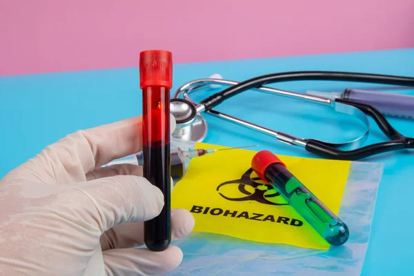 COVID 19 Coronavirus Muestra de sangre infectada en el tubo de muestra ...