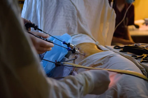 ᐈ Laparoscopic stock images, Royalty Free laparoscopic surgery pictures ...