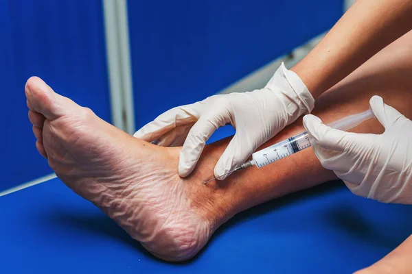Foot injection Stock Photos, Royalty Free Foot injection Images ...