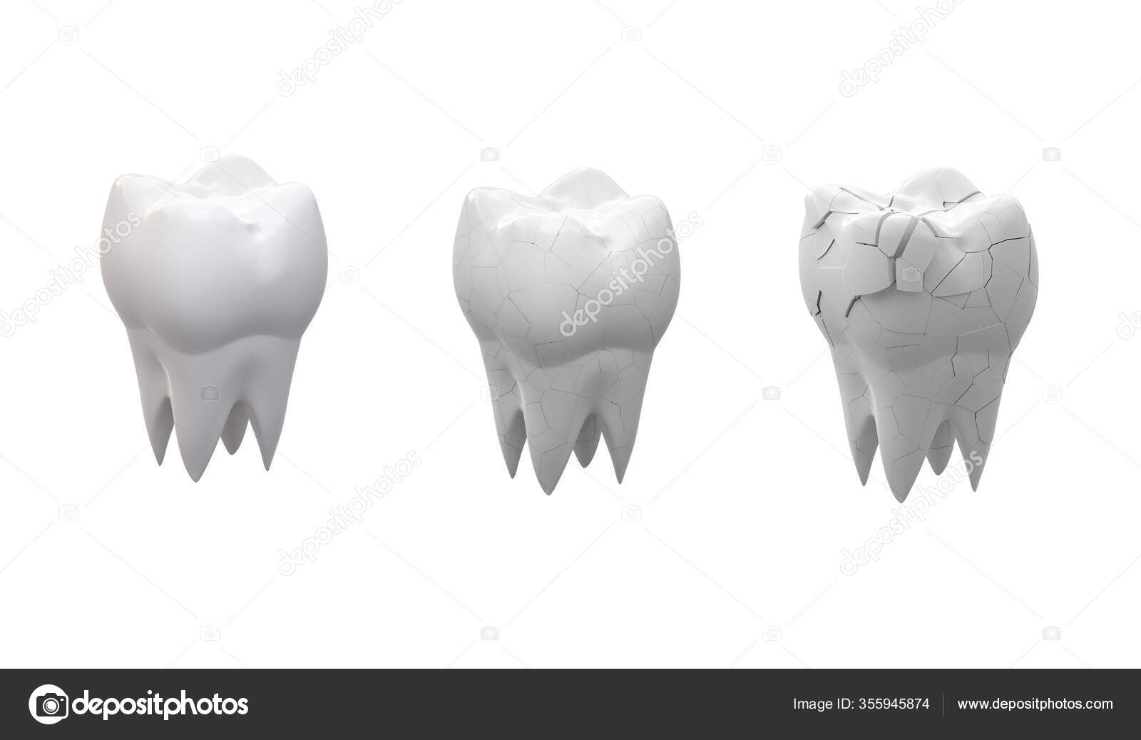 Broken Molars Tooth Whole Tooth Isolated White Background Illustration ...