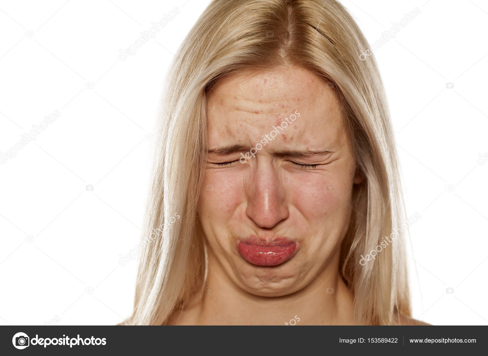 Cuidado de la piel - piel problemática — Foto de stock #153589422 ...