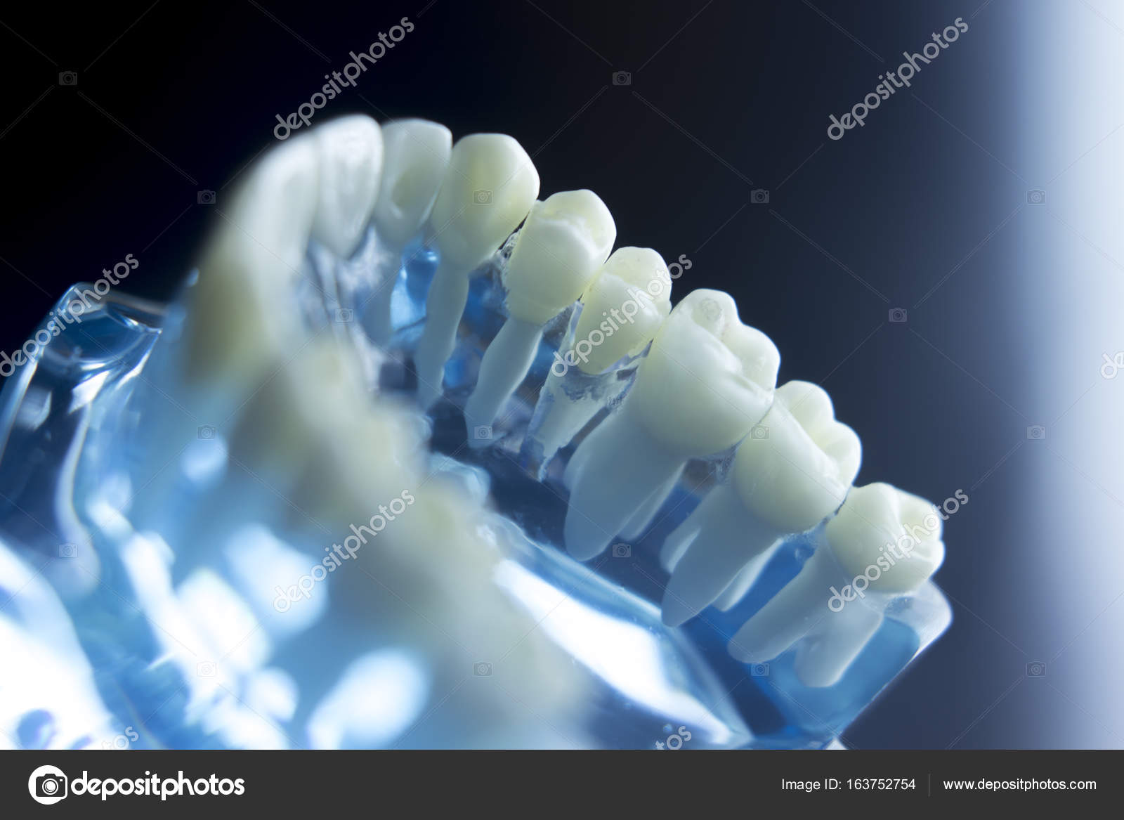 Dental teeth decay model Stock Photo by ©edwardolive 163752754