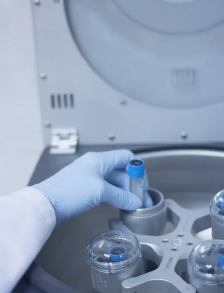 Platelet rich plasma Stock Photos, Royalty Free Platelet rich plasma ...