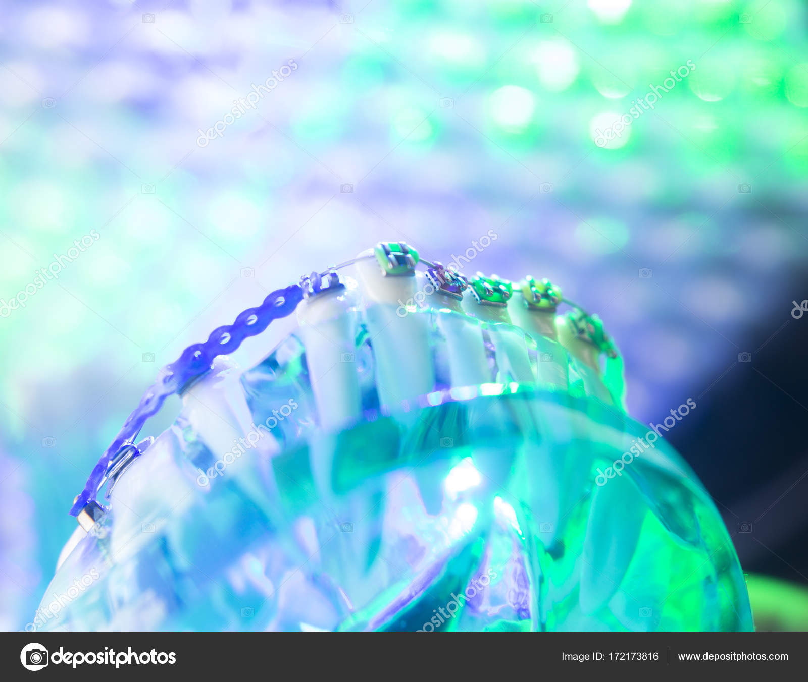 Dental teeth metal brackets Stock Photo by ©edwardolive 172173816