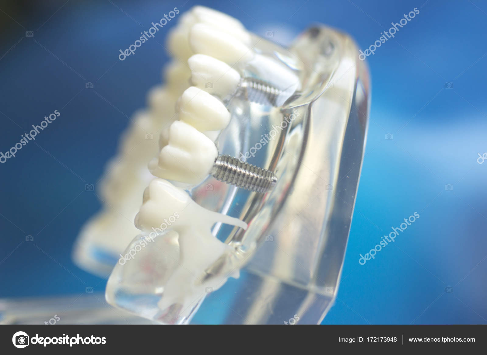 Modelo de boca de dientes dentales: fotografía de stock © edwardolive ...