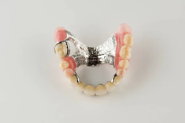 Clasp prosthesis with and latch ceramic crowns Stock Photo by ©Krezofen ...