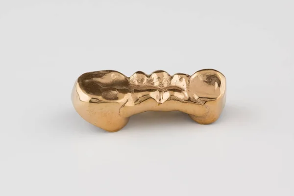 Gold teeth Stock Photos, Royalty Free Gold teeth Images | Depositphotos