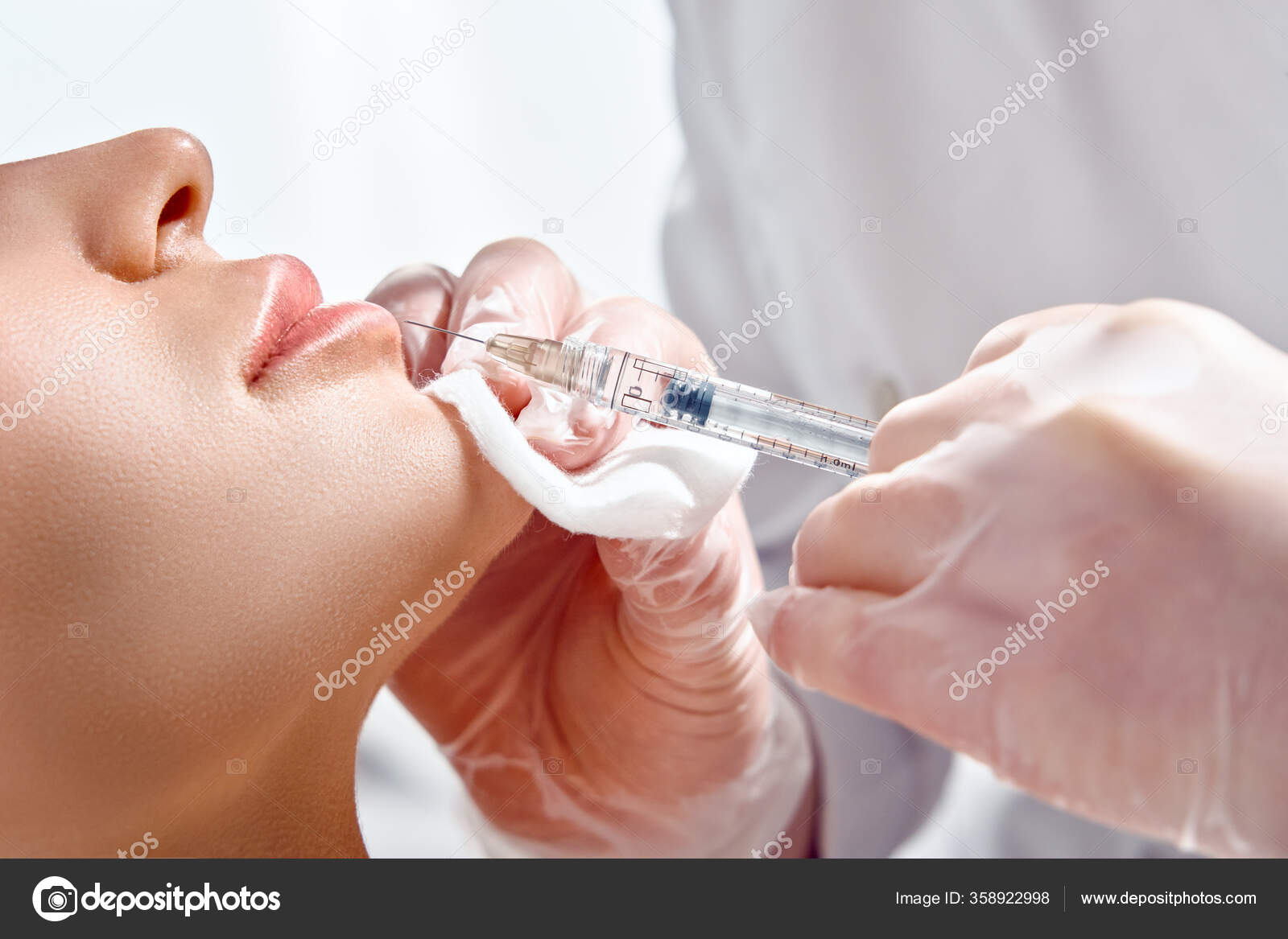 Lip shape correction procedure in a cosmetology salon. The specialist ...