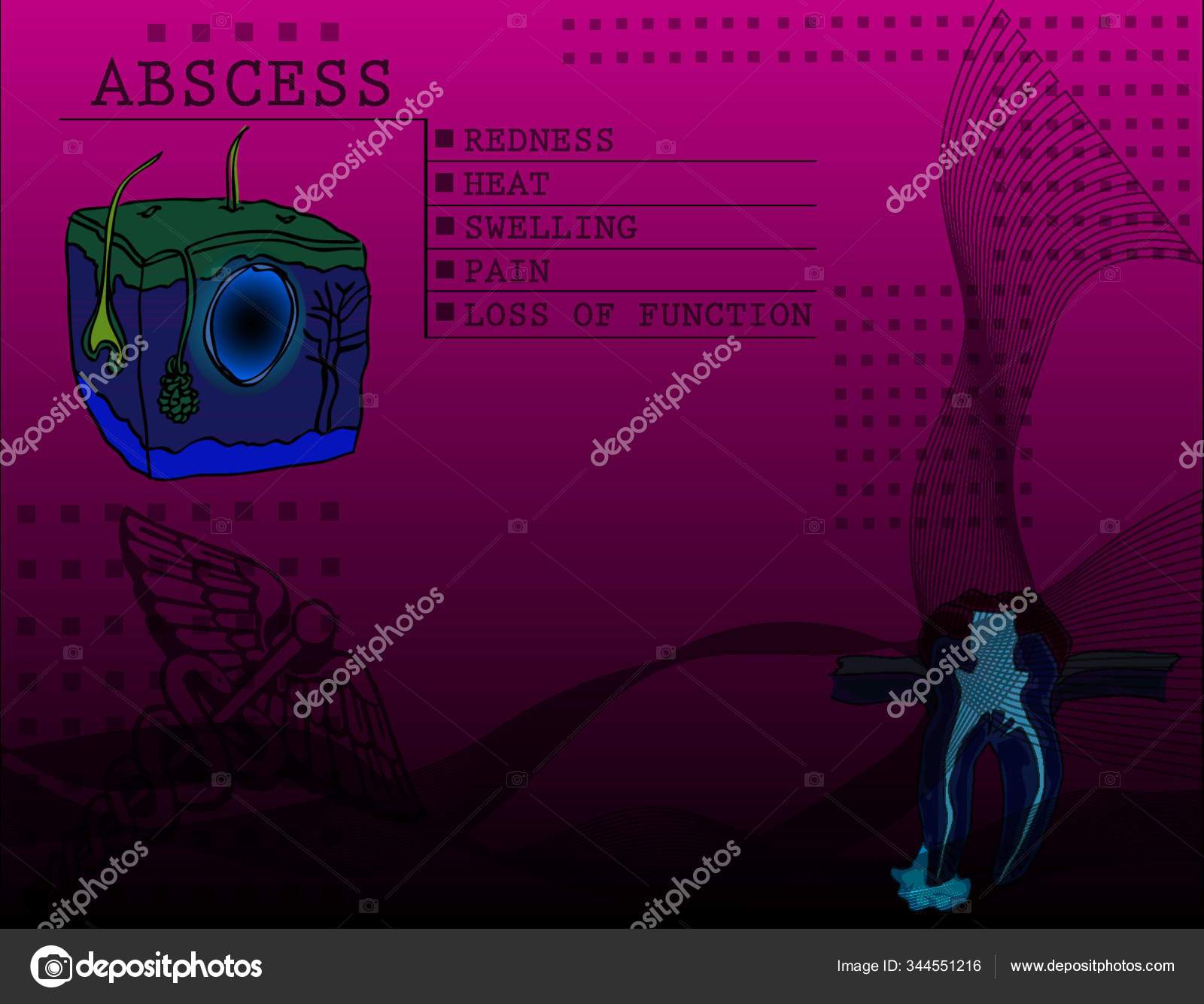 Background Disease Abscess Illustrations Medical Symbols Stock Vector ...