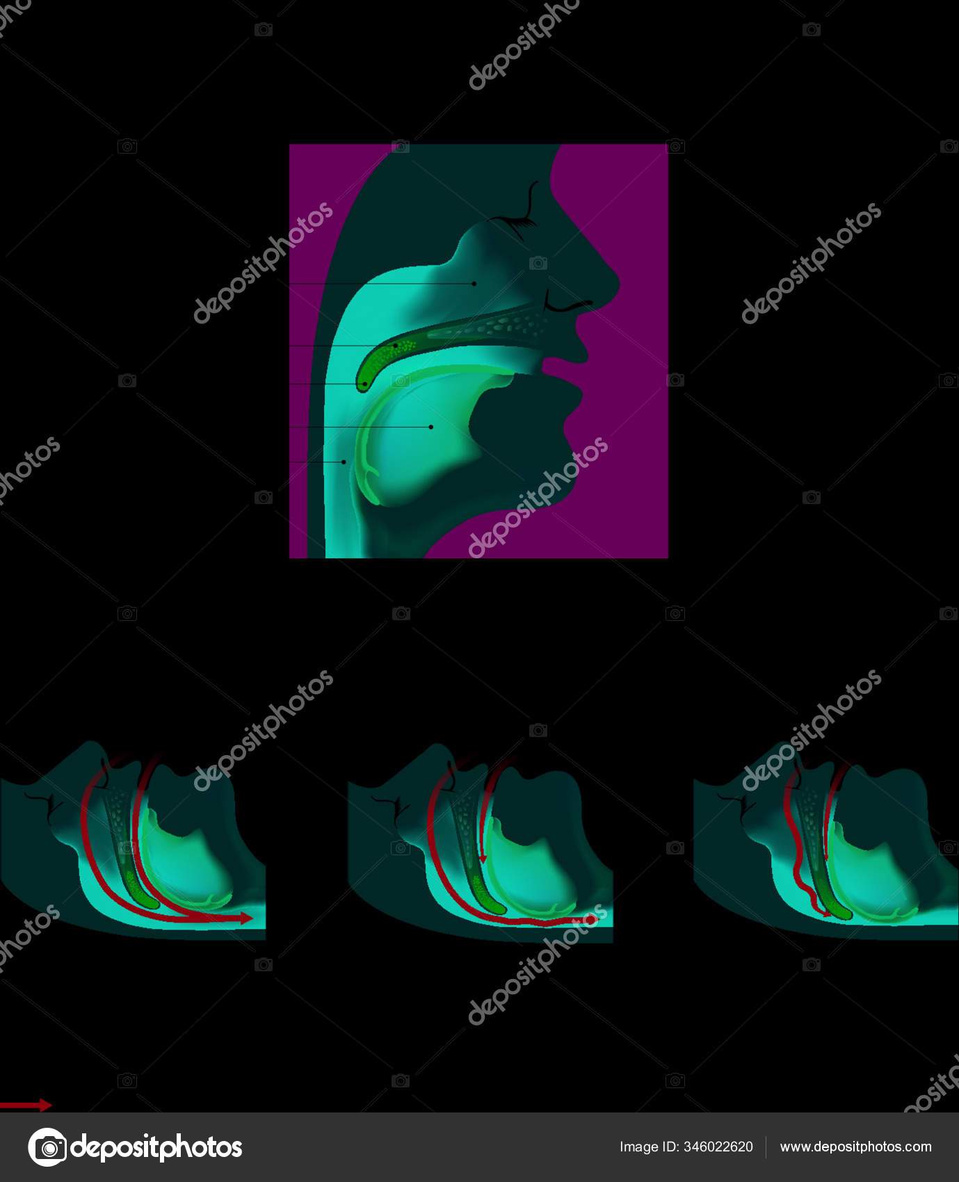 Snoring Vibration Respiratory Structures Resulting Sound Due Obstructed ...