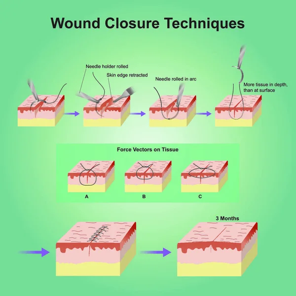 Contusion Vector Art Stock Images | Depositphotos