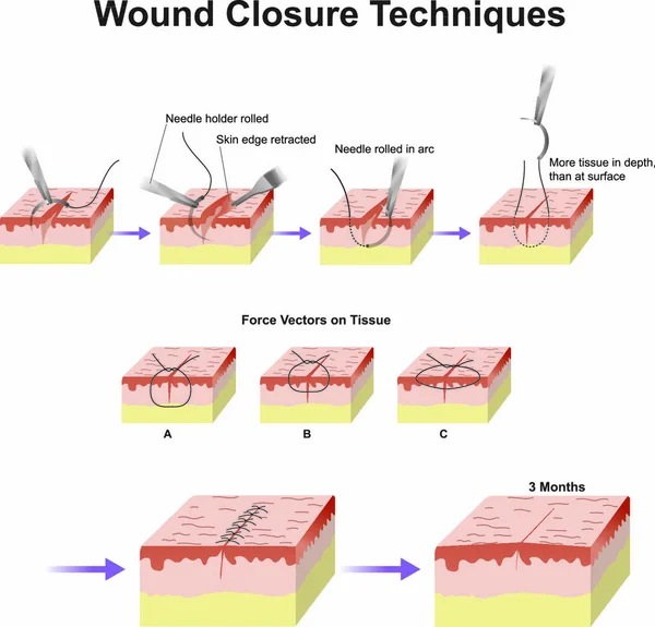 Contusion Vector Art Stock Images | Depositphotos