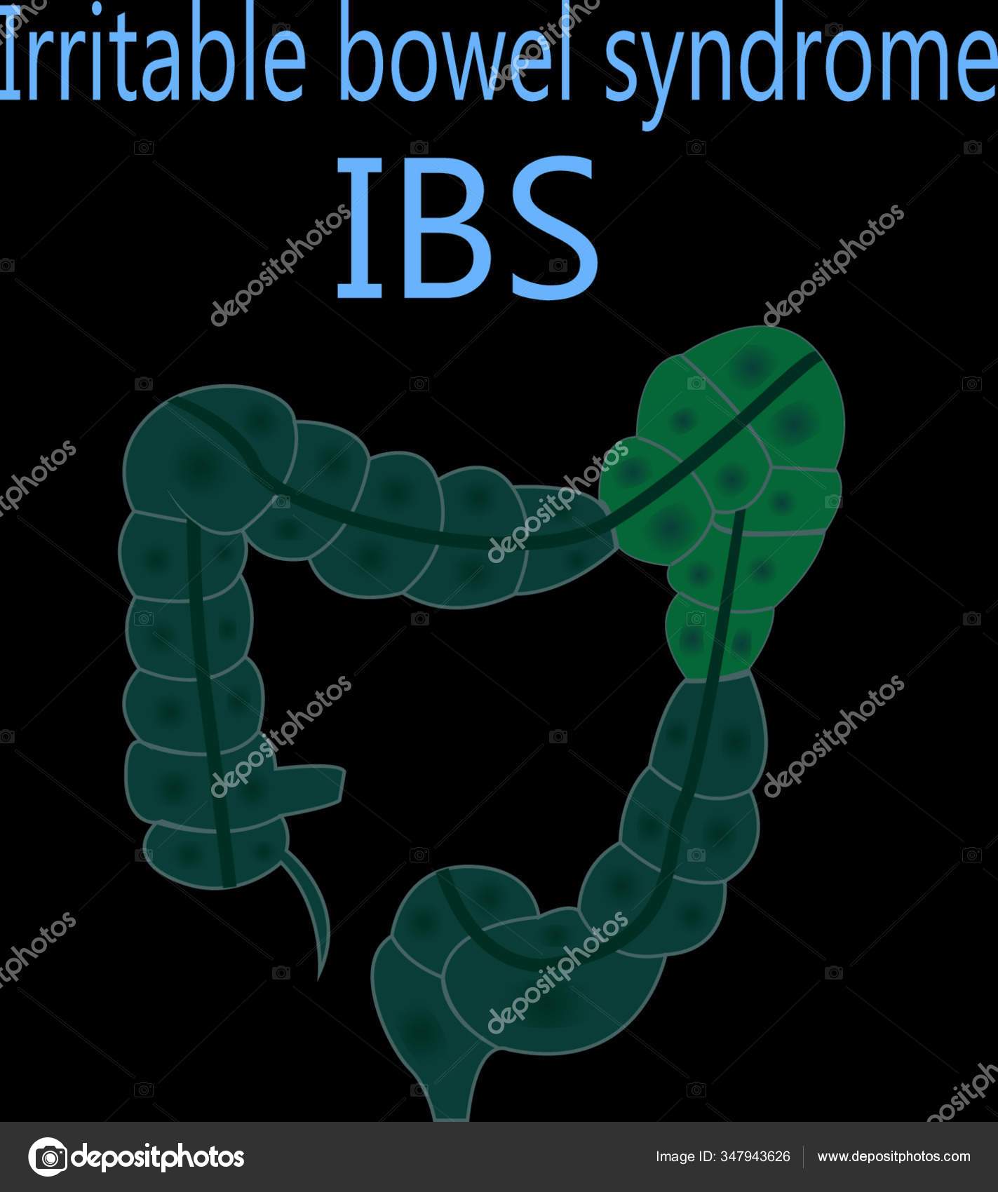 Irritable Bowel Syndrome Ibs Large Intestine Vector Illustration ...