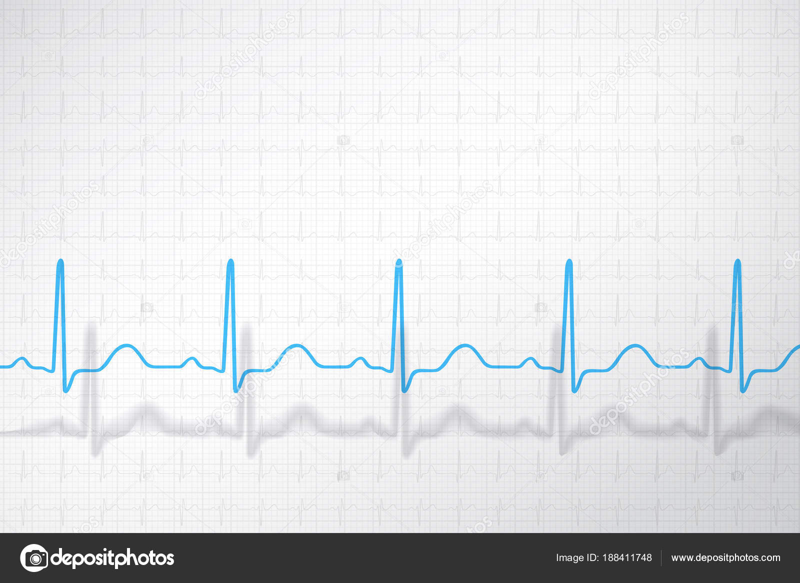 Normální EKG graf zdravého člověka, koncepční vektorové pozadí Stock ...