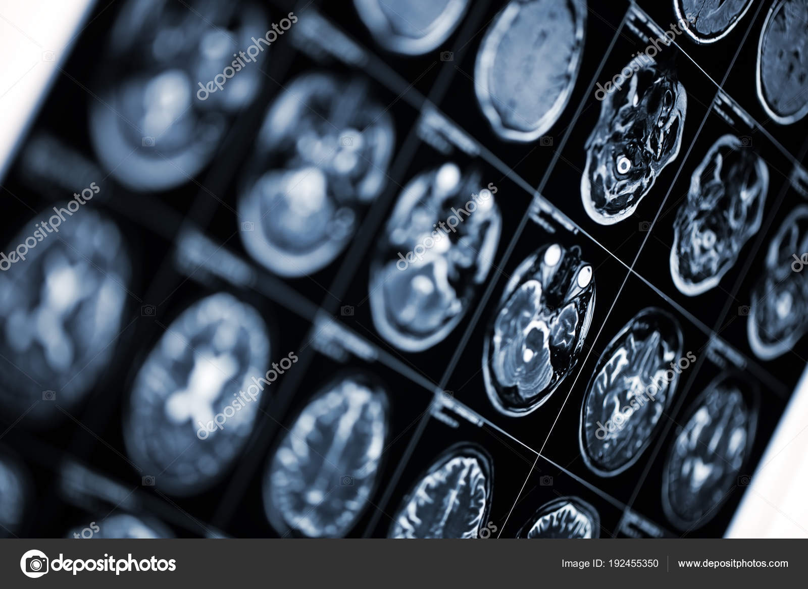 Medical background with MRI scan image of human head Stock Photo by ...