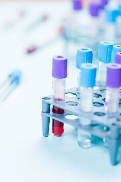 Lab testing Stock Photos, Royalty Free Lab testing Images | Depositphotos