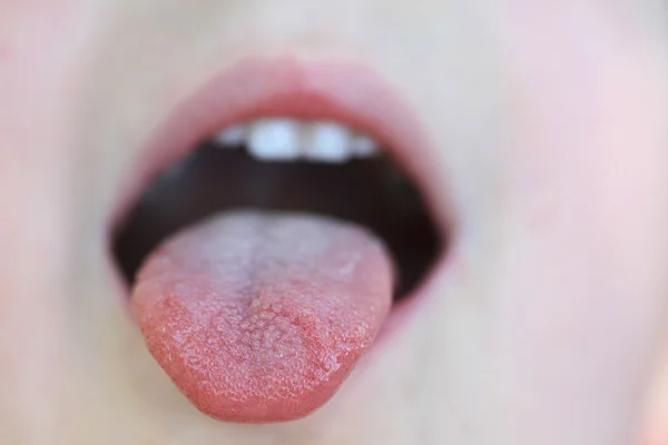 What causes a coated tongue Stock Photos, Royalty Free What causes a ...