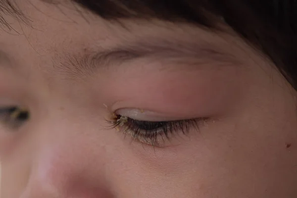 Festering Stock Photos, Royalty Free Festering Images | Depositphotos®