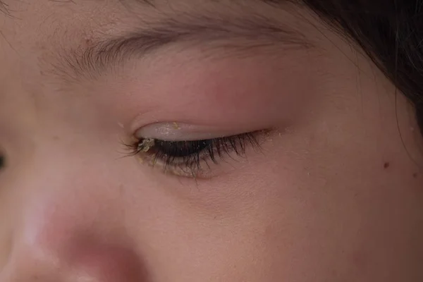 Festering Stock Photos, Royalty Free Festering Images | Depositphotos®