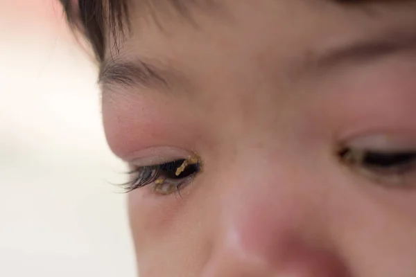 Festering Stock Photos, Royalty Free Festering Images | Depositphotos®