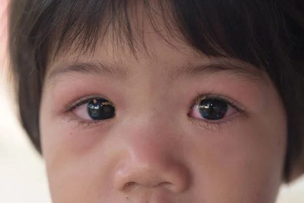 Festering Stock Photos, Royalty Free Festering Images | Depositphotos®