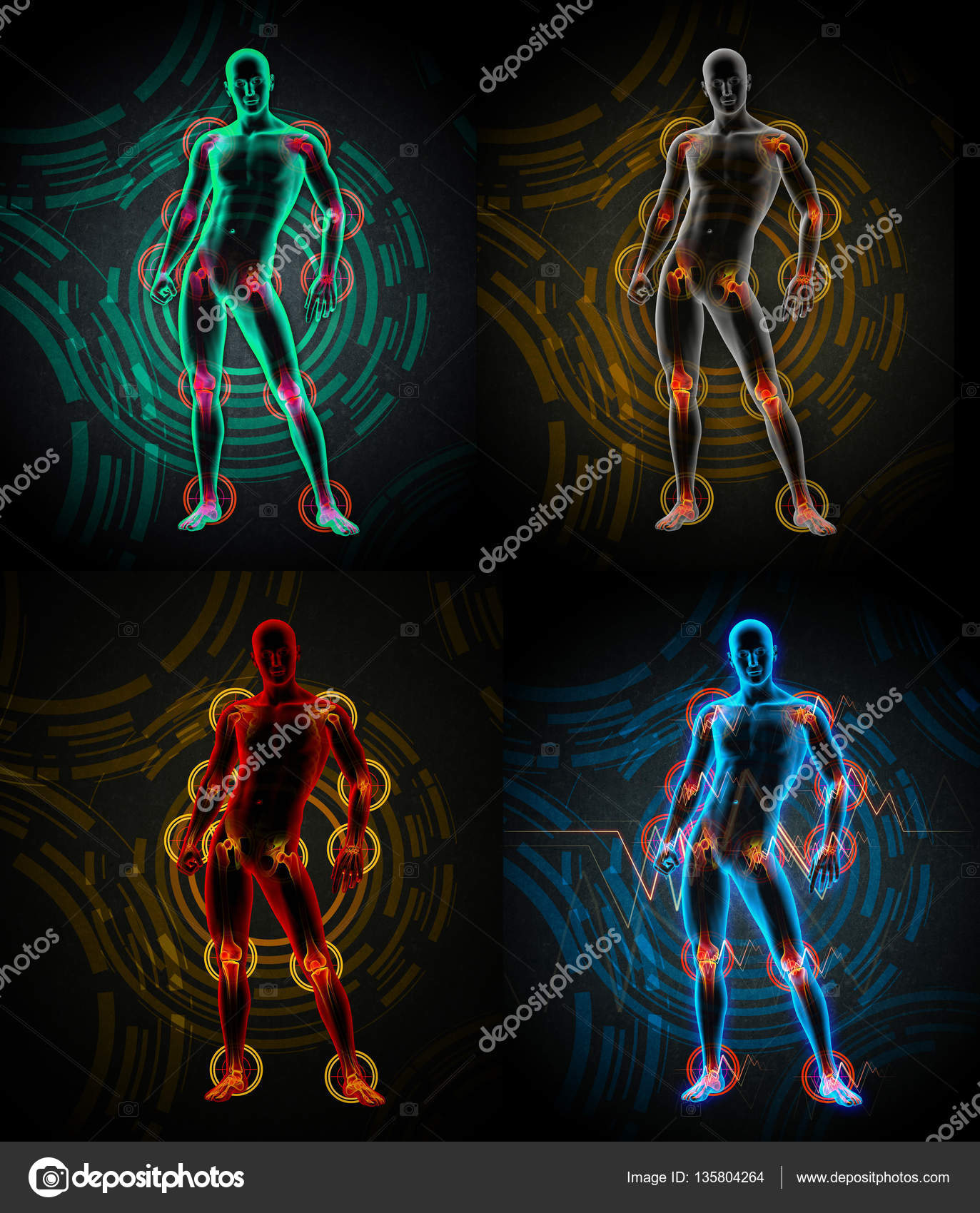 3D rendering medical illustration of a painful joint — Stock Photo ...