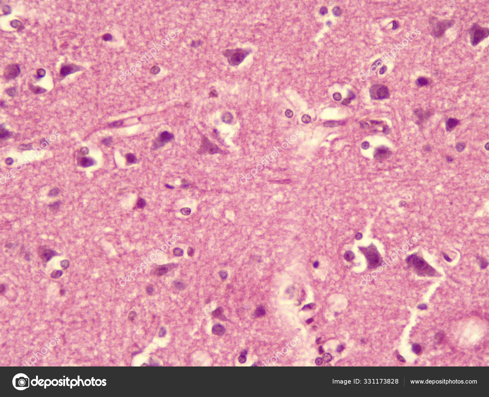 Nervous Tissue Slide 400x