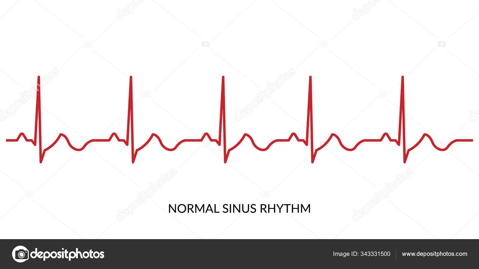 ECG Heartbeat Line. Electrocardiogram vector illustration. Normal Sinus ... ECG Heartbeat Line. Electrocardiogram vector illustration. Normal Sinus ...