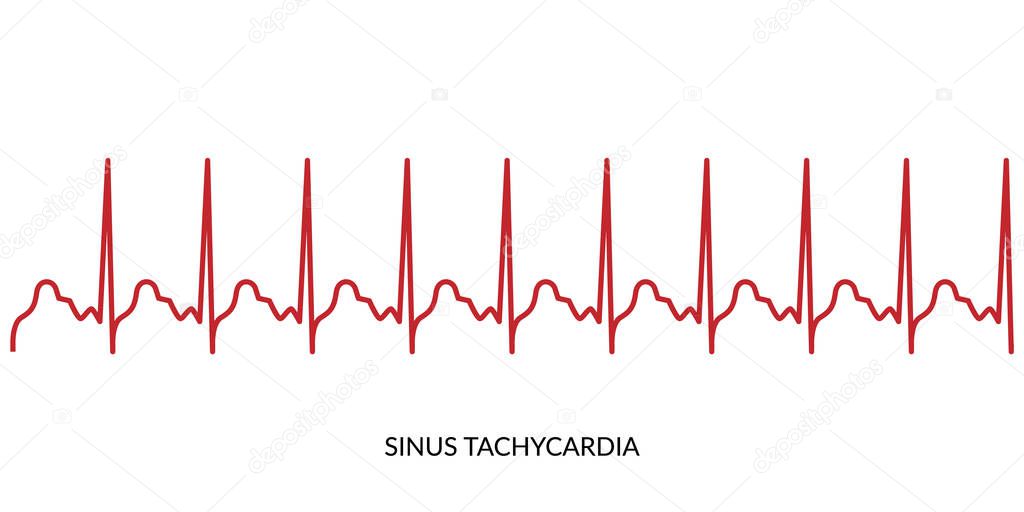 ECG Heartbeat Line. Ilustración de vectores de electrocardiograma ...