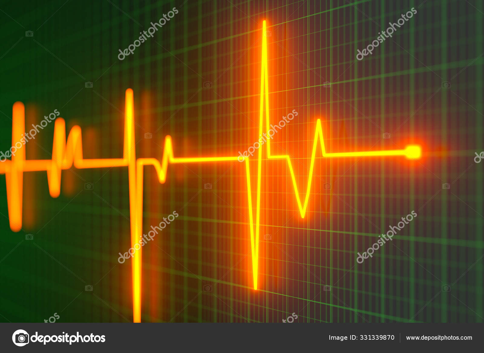 Heartbeat Monitor Dead
