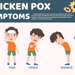 Children Has Chicken Pox Infographic Poster Children Fever Chickenpox ...