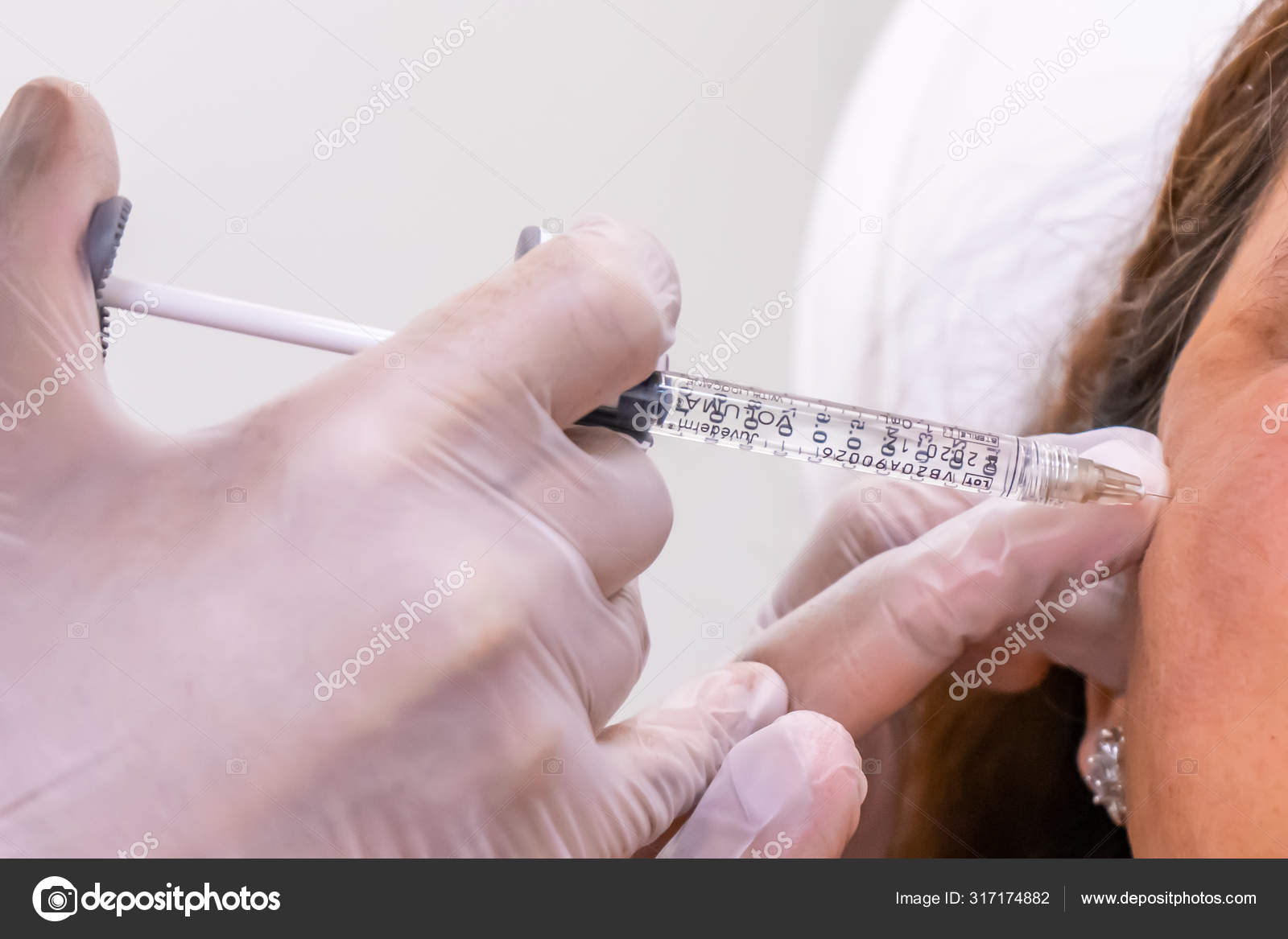 Gloved doctor hand injecting a vial of hyaluronic acid (HA) based ...