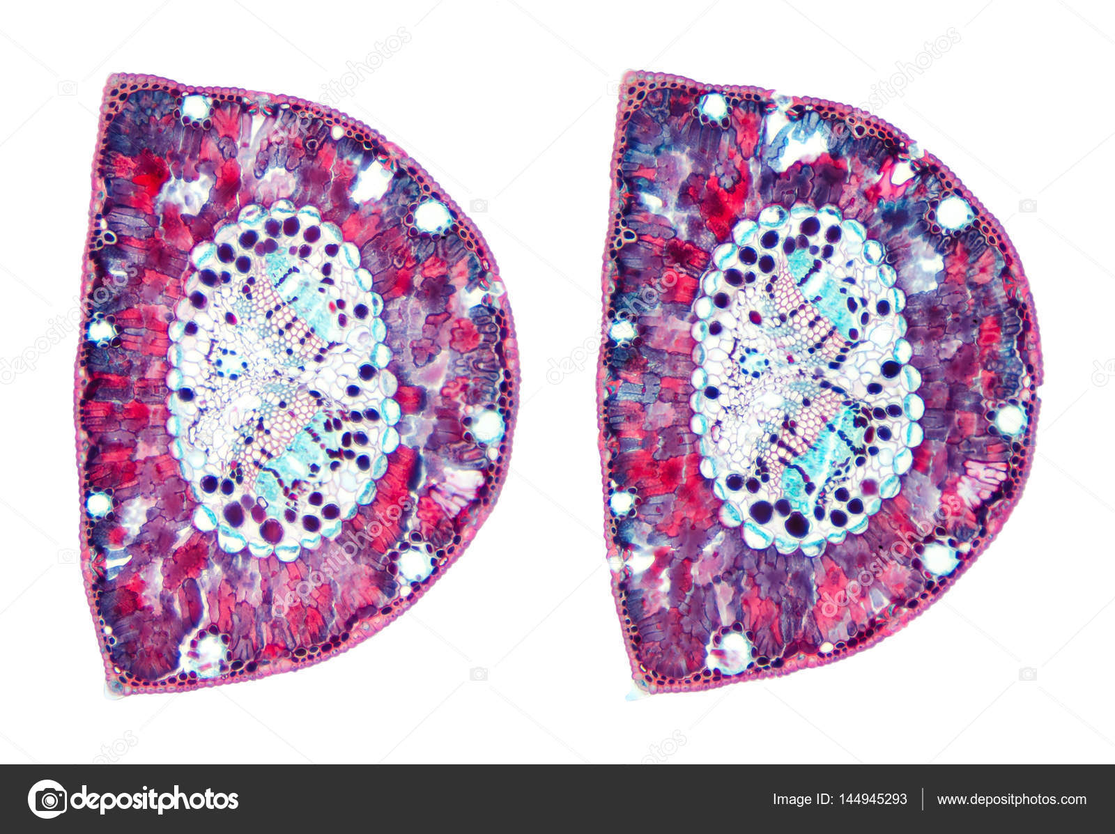Pine Leaf Cross Section