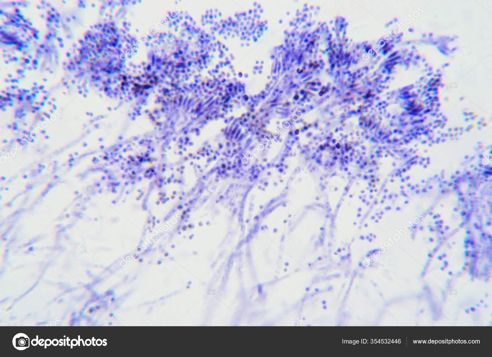 Microscopio De Hifas De Fungos Ramos Penicillium Fungos Ascomicetos