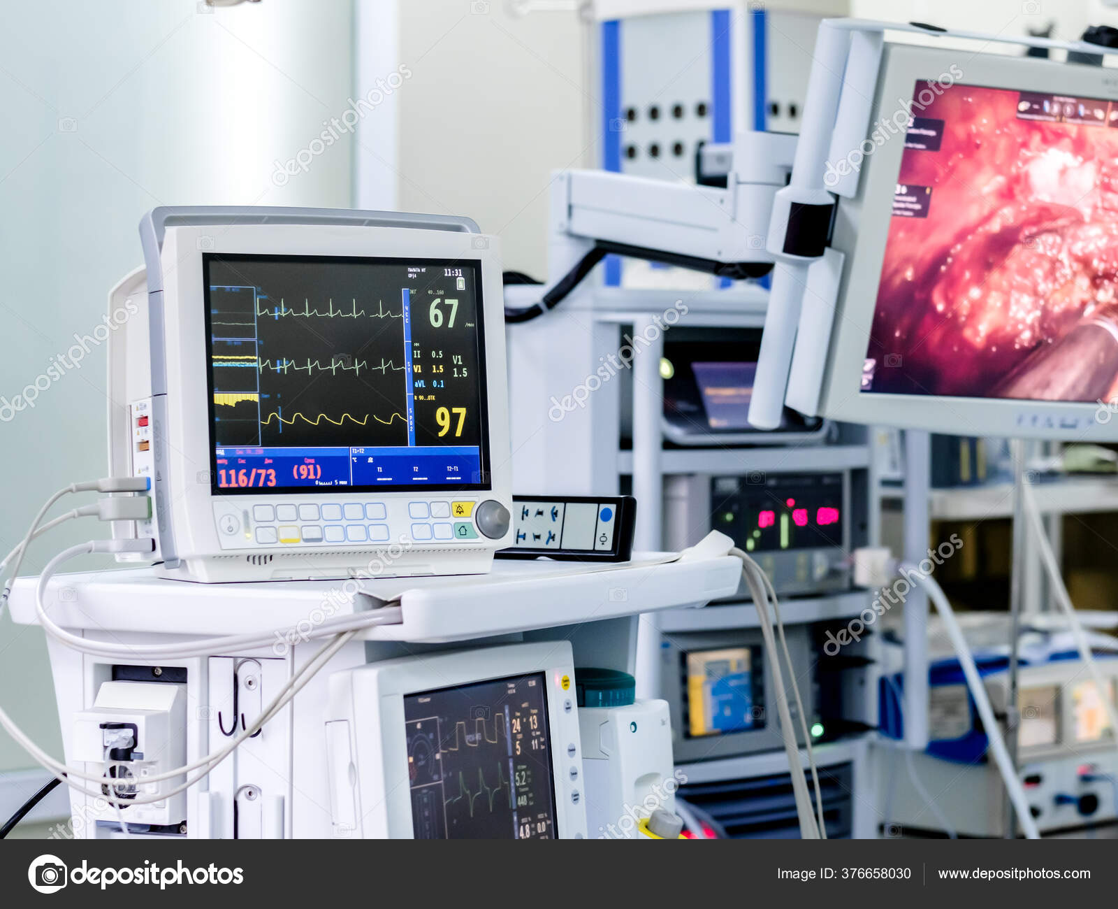Monitoring Patient Vital Functions Surgery High Tech Medical Equipment ...