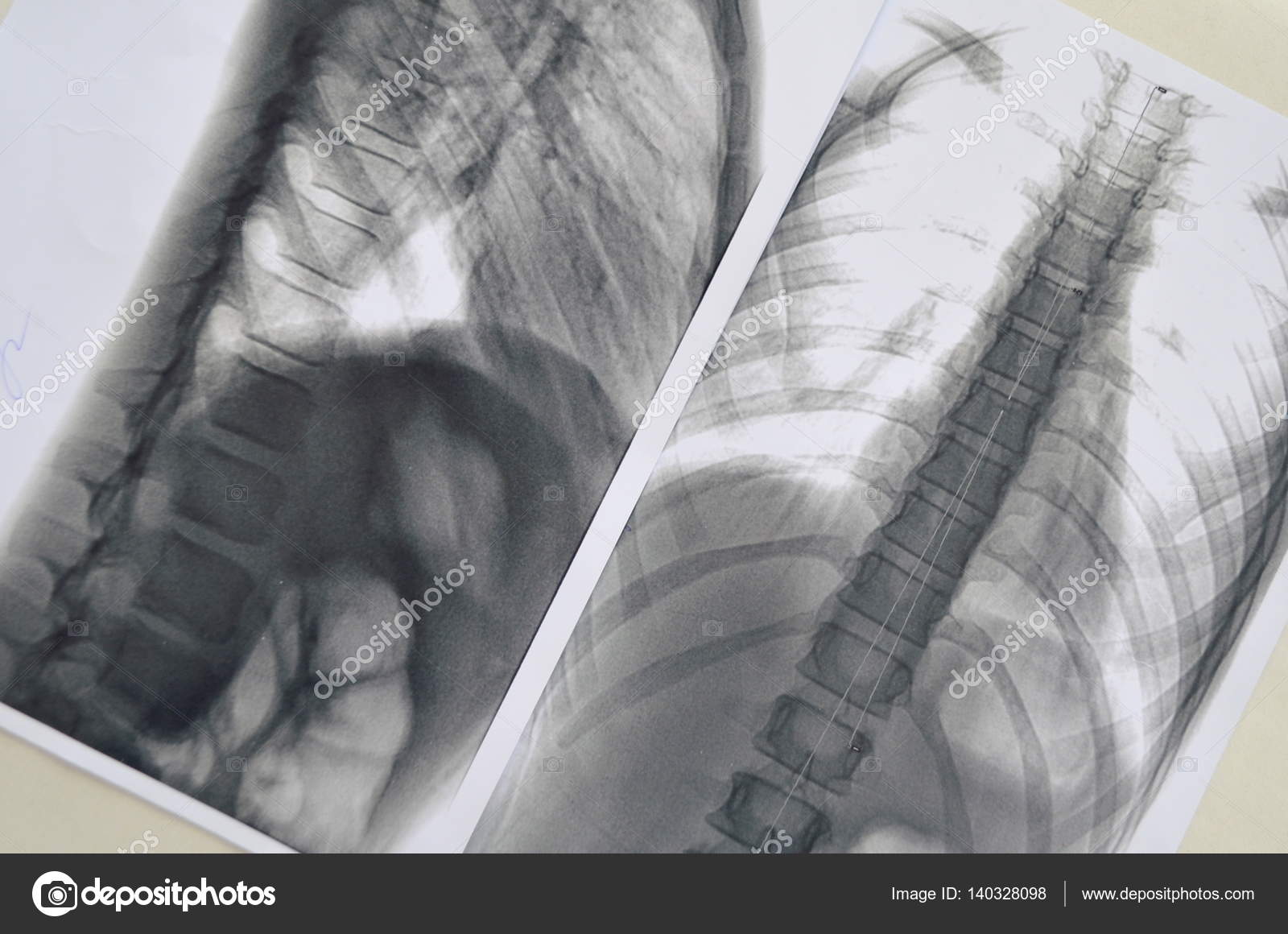 Rengen spine picture - diagnosis examination Stock Photo by ©YuliyaM ...