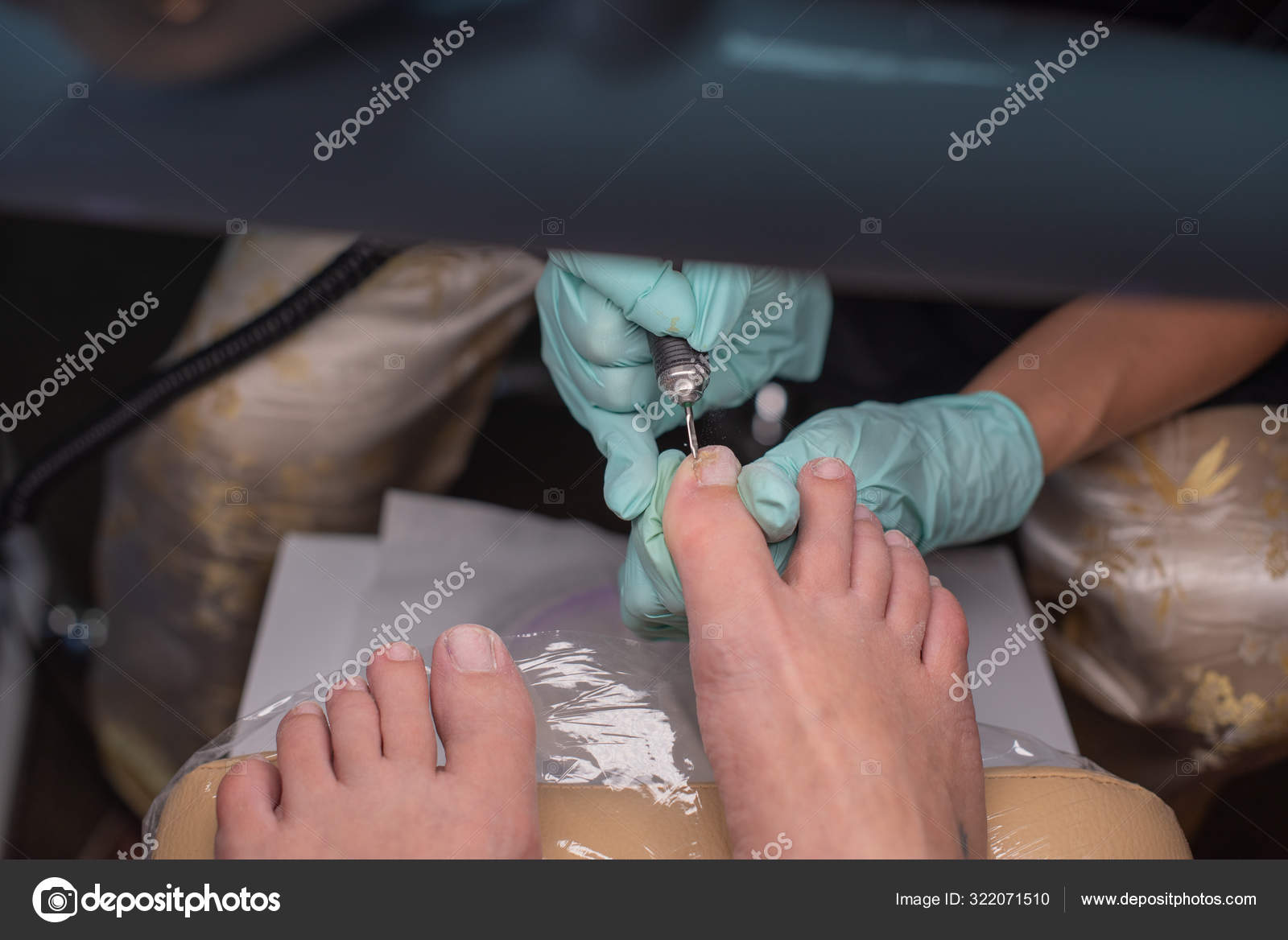 Podiatrist Treating Toenail Fungus Podology Treatment Podology