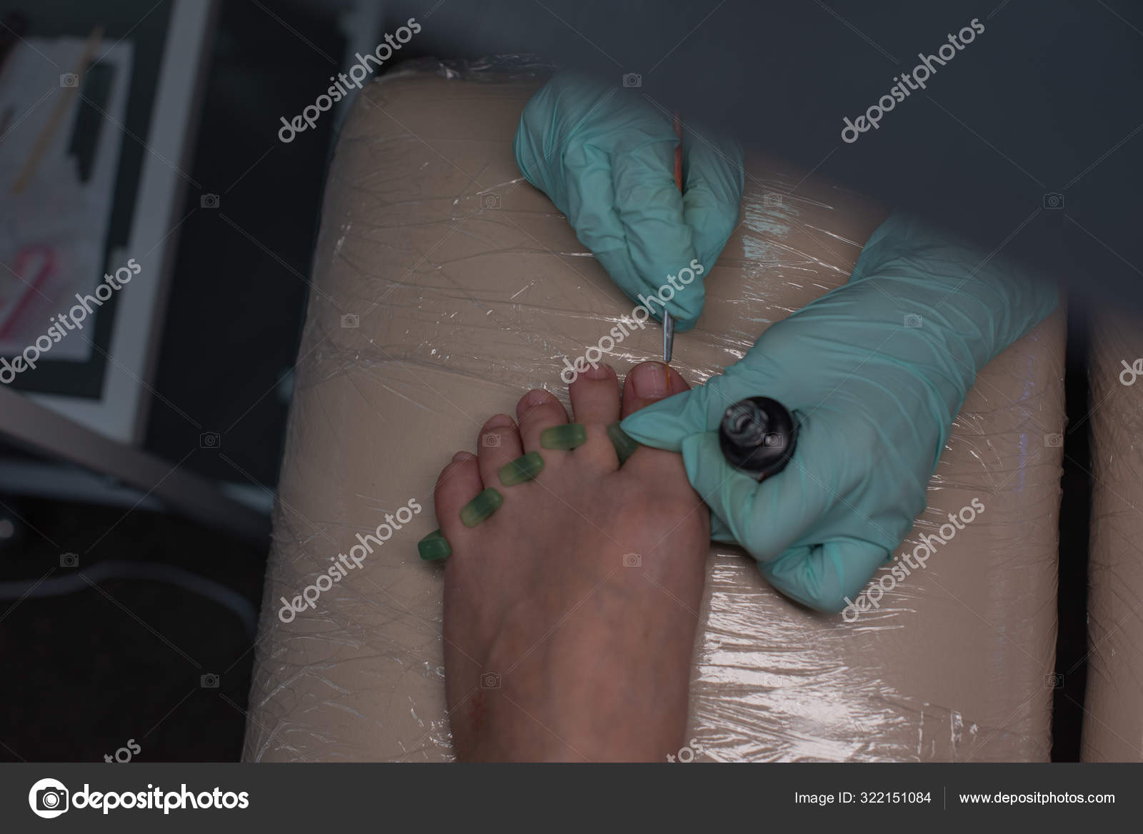 Podiatrist Treating Toenail Fungus Podology Treatment Podology