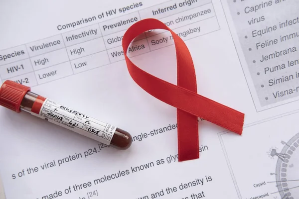 Imagem de fita hiv Stock Photos, Royalty Free Imagem de fita hiv Images ...