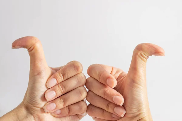 Caucasian Female Hand Hyper Flexible Thumbs Curved Thumbs Hitchhiker's ...