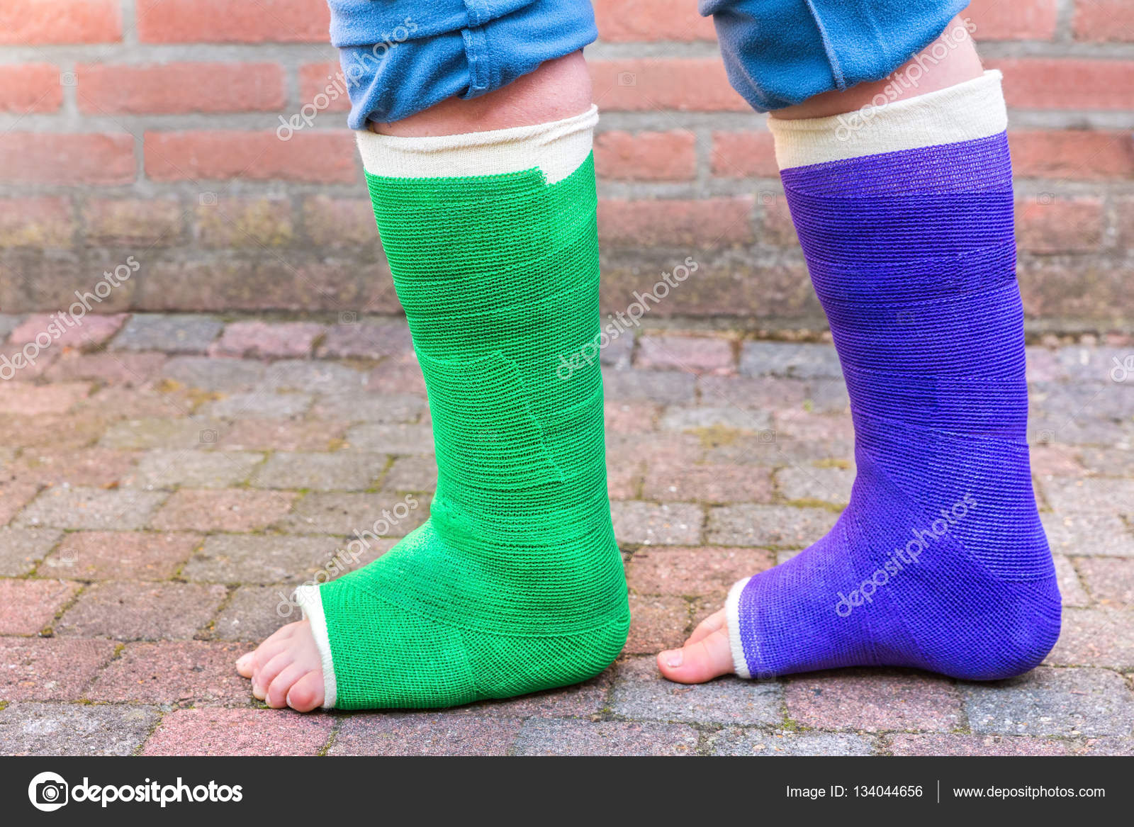 Stående barn med två färgglada gips ben — Stockfotografi ...