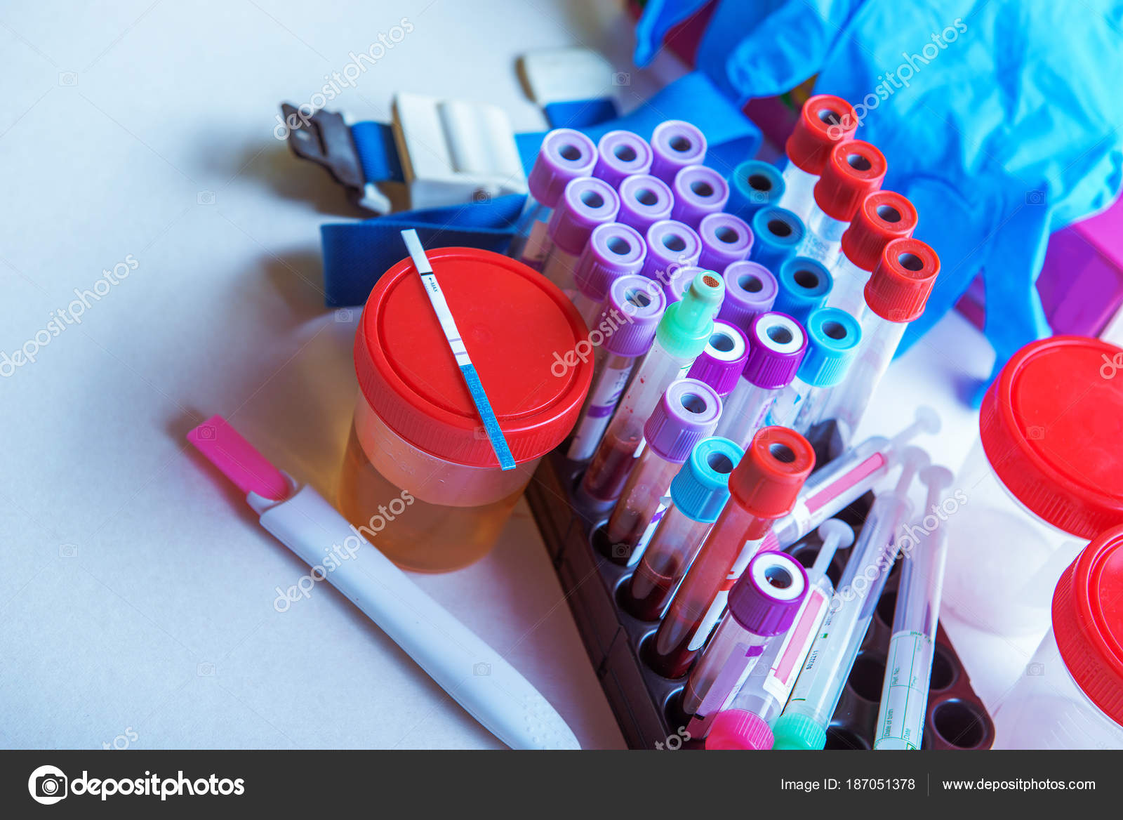 Pregnancy Test Hcg Laboratory Research Stock Photo by ©nata-lunataD ...