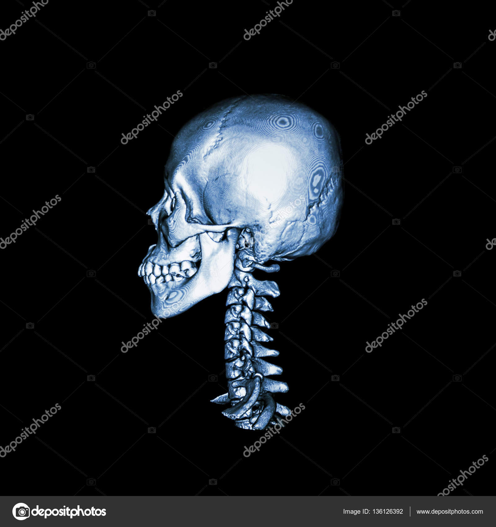CT scan avec image 3D du crâne humain normal et de la colonne cervicale ...