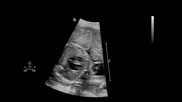 Ultrasound neck Stock Photos, Royalty Free Ultrasound neck Images ...