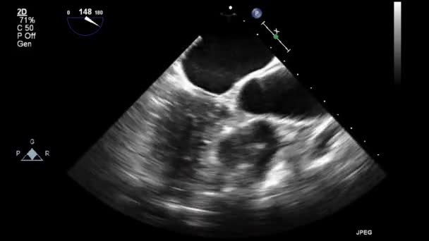 Ultraljud Stockvideor, royaltyfria Ultraljud filmer | Depositphotos®