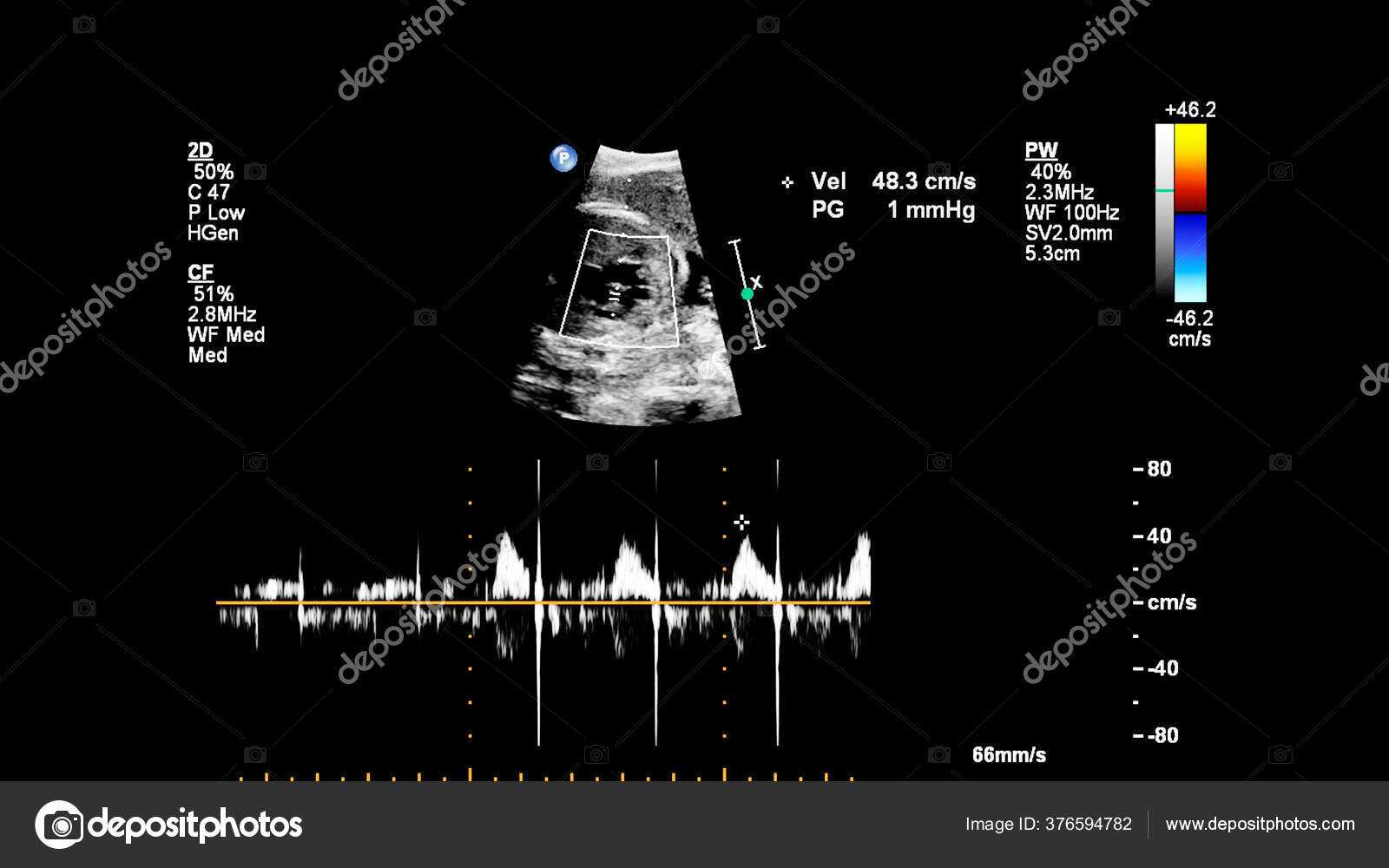 Ultrasound Screen Fetal Echocardiography — Stock Photo © Faustasyan ...